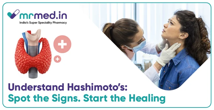 Hashimoto's Disease: Hypothyroidism, Symptoms, Diagnosis, and Management