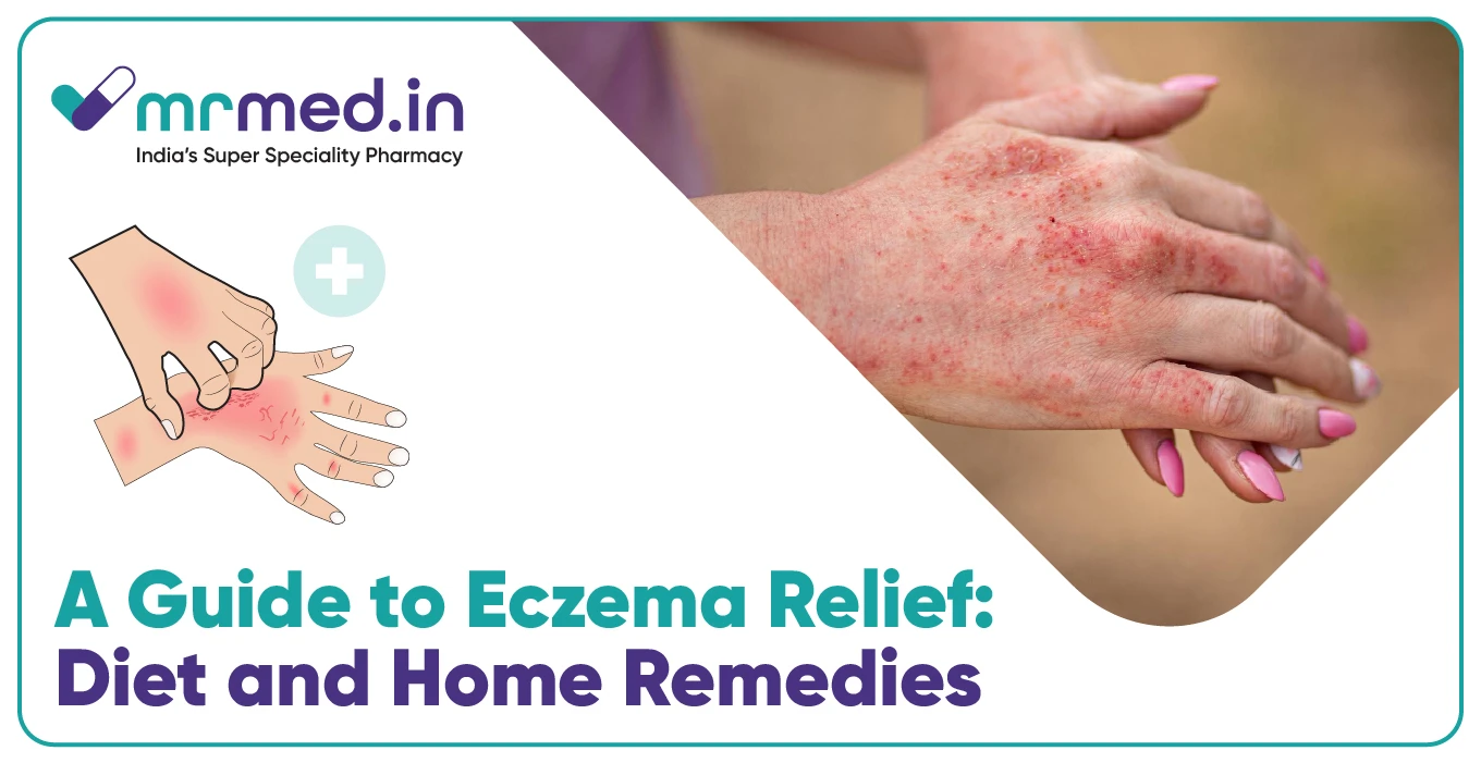 Living with Eczema: Skincare Routine, Diet Tips, and Home Remedies