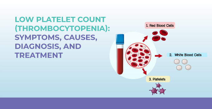 Low Platelet Count (Thrombocytopenia): Symptoms, Causes, Diagnosis, and ...