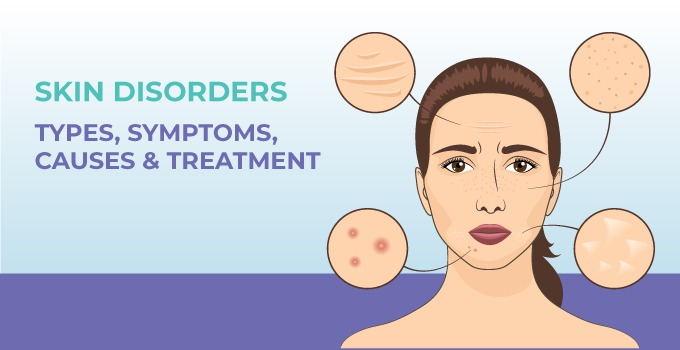Skin Disorders - Types, Symptoms, Causes & Treatment | MrMed
