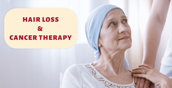 Cancer Therapy Hair Loss: Causes, Prevention & Management | MrMed
