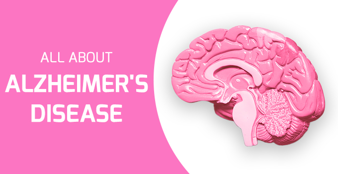 Alzheimer Disease Causes, Symptoms, Treatment And Frequently Asked ...