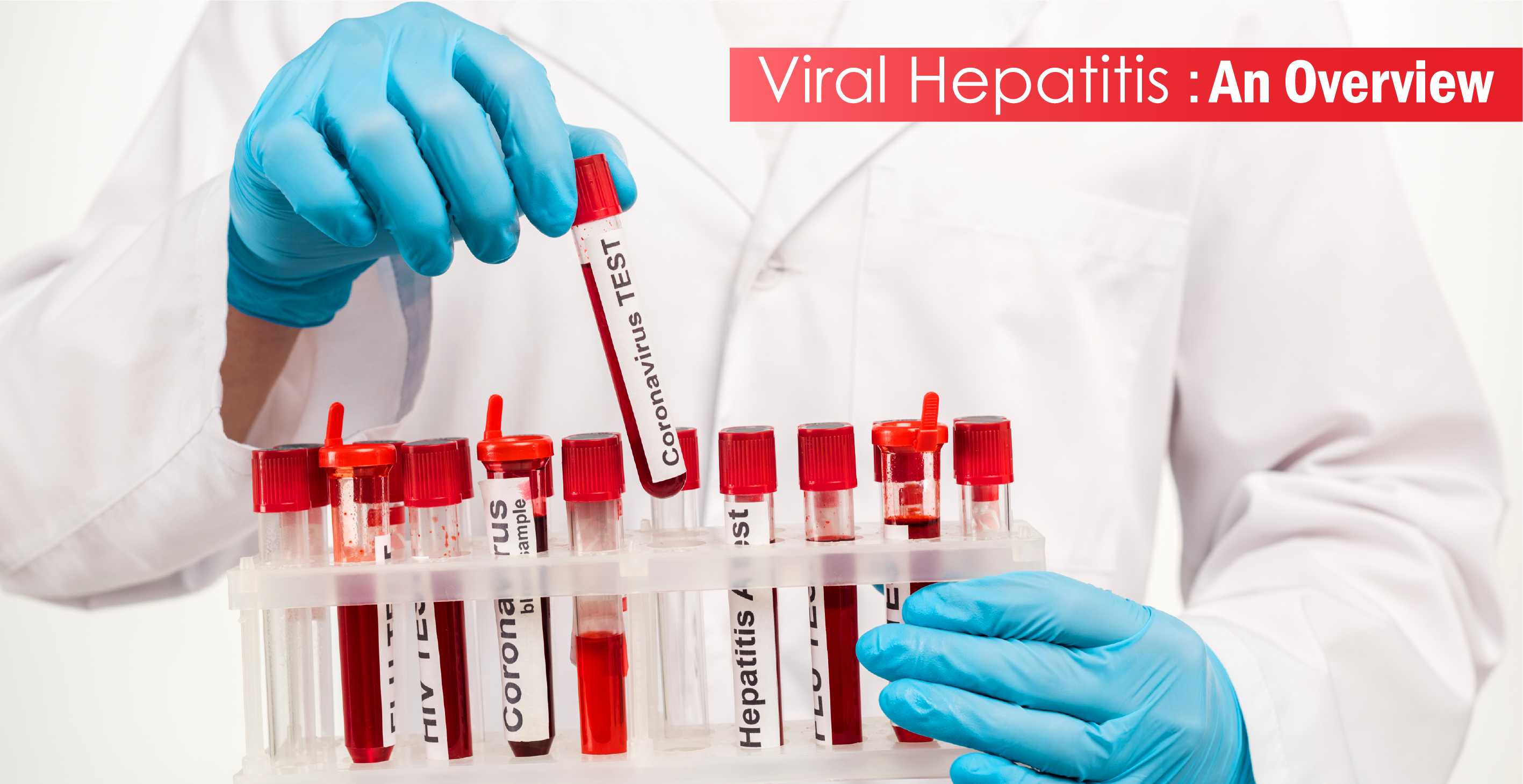 All You Need To Know About Viral Hepatitis | MrMed