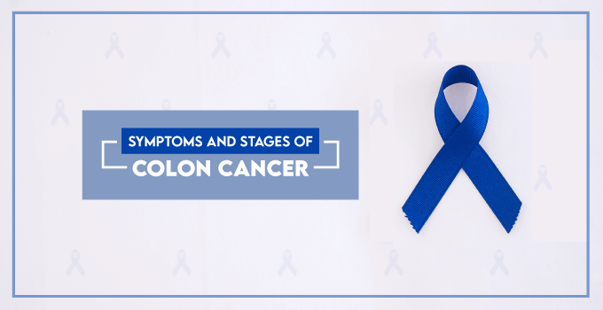 Stages And Symptoms Of Colon Cancer | MrMed