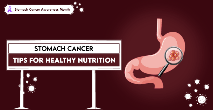 Stomach Cancer Diet Plan To Follow | MrMed