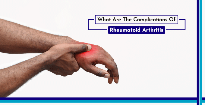 Rheumatoid Arthritis Complications - Signs, Symptoms And Prevention | MrMed