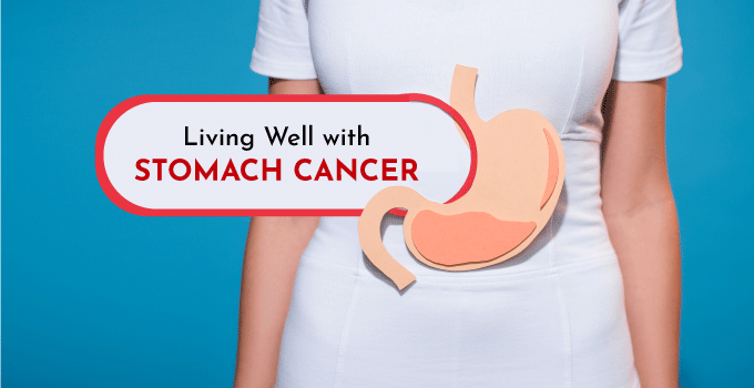 Living well before, during, and after stomach cancer in stomach cancer ...