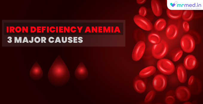 3 Main Causes of iron deficiency anemia that everyone should know | MrMed