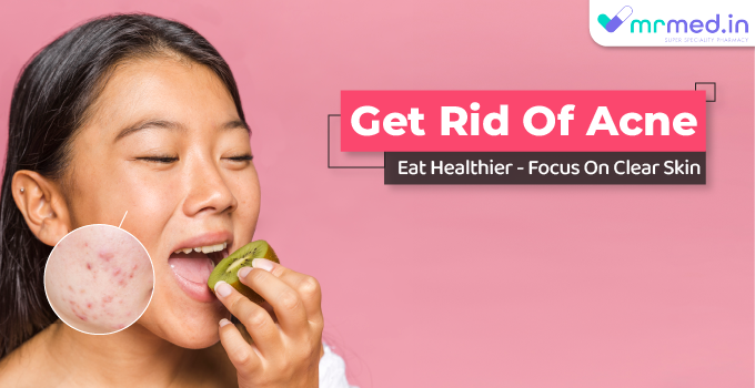 All you need to know about acne, its causes and treatments - MrMed