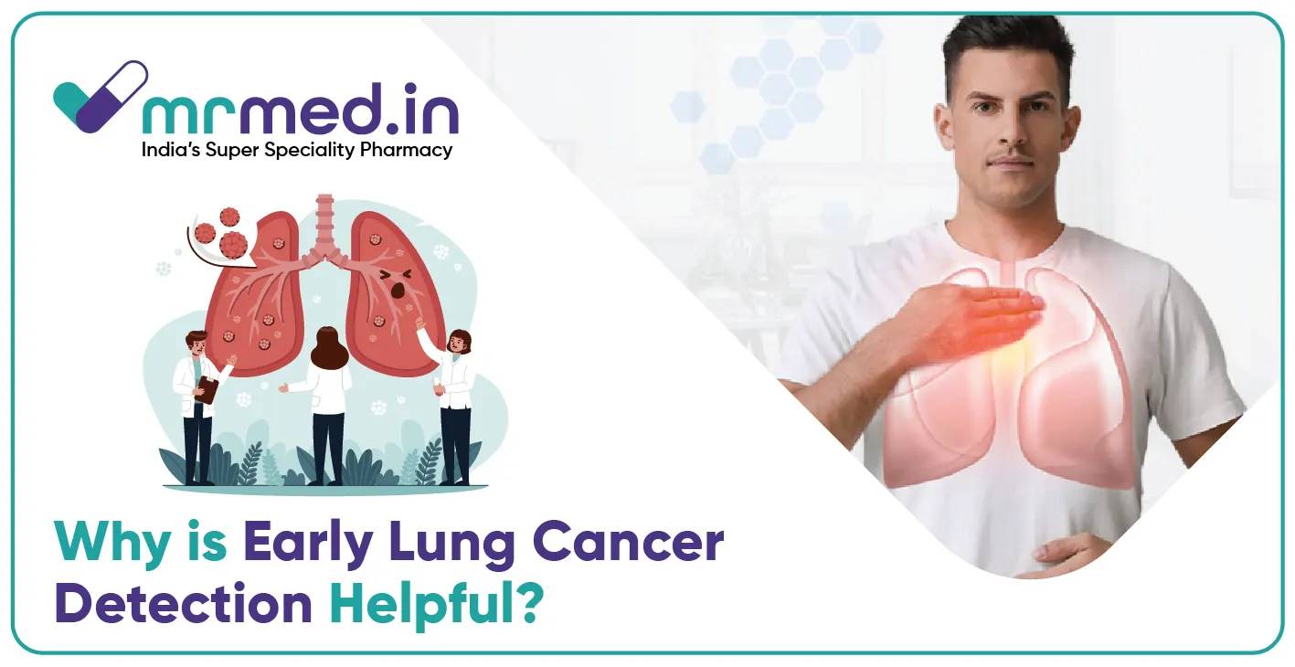 Know everything about lung cancer early detection and screening | MrMed