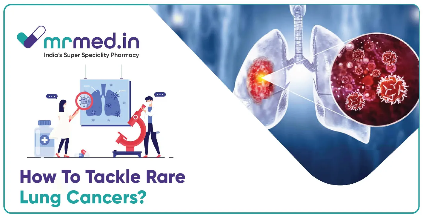 Challenges and Solutions for Rare Lung Cancer: Diagnosis & Treatment