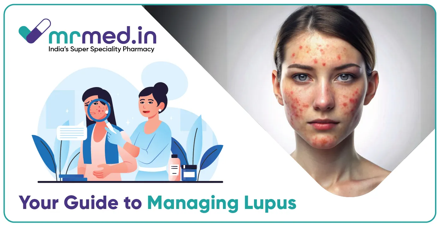 Lupus Symptoms, Causes & Treatment Guide